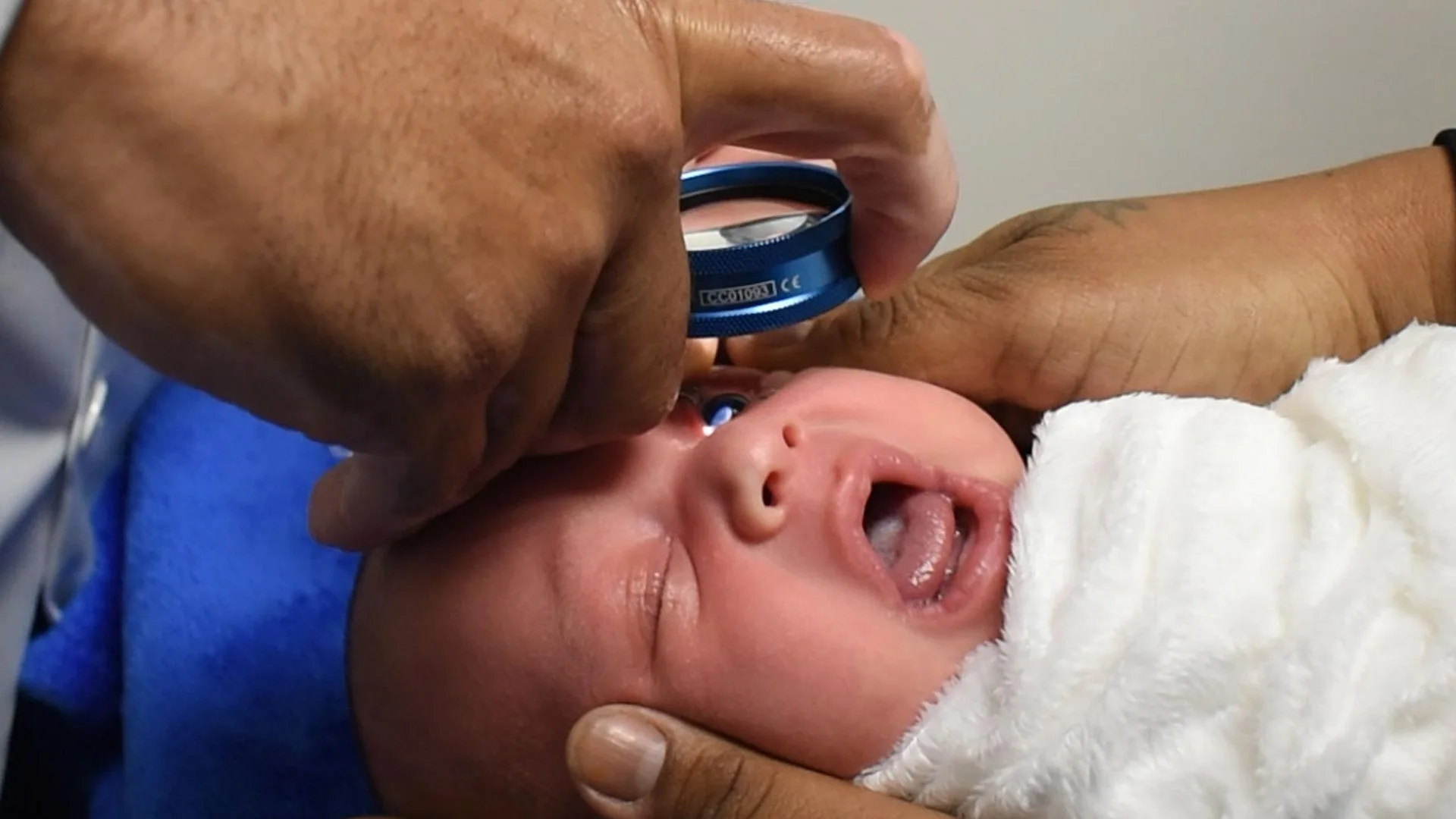 Retinopatía de la Prematuridad | Blog y Noticias | CIVE